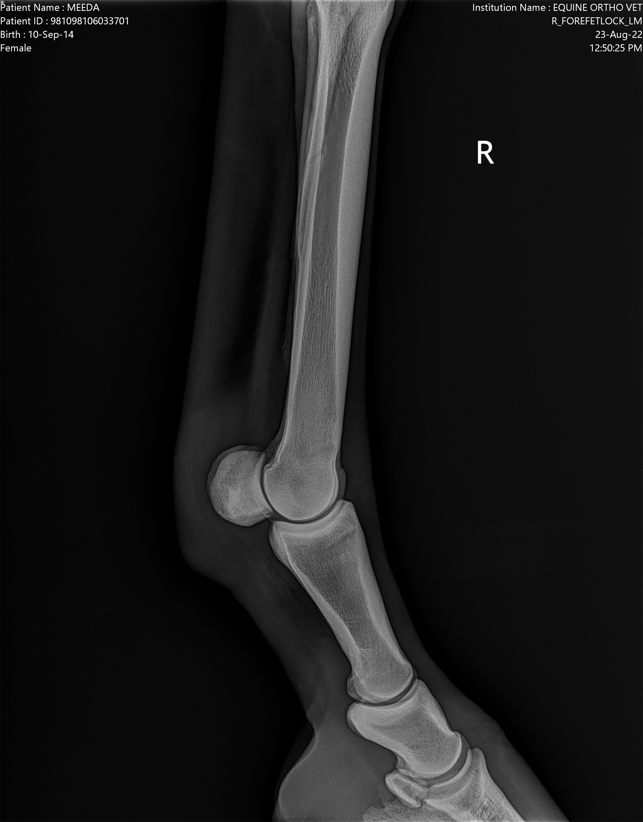 Belgian Horse Trading | 5. Meeda