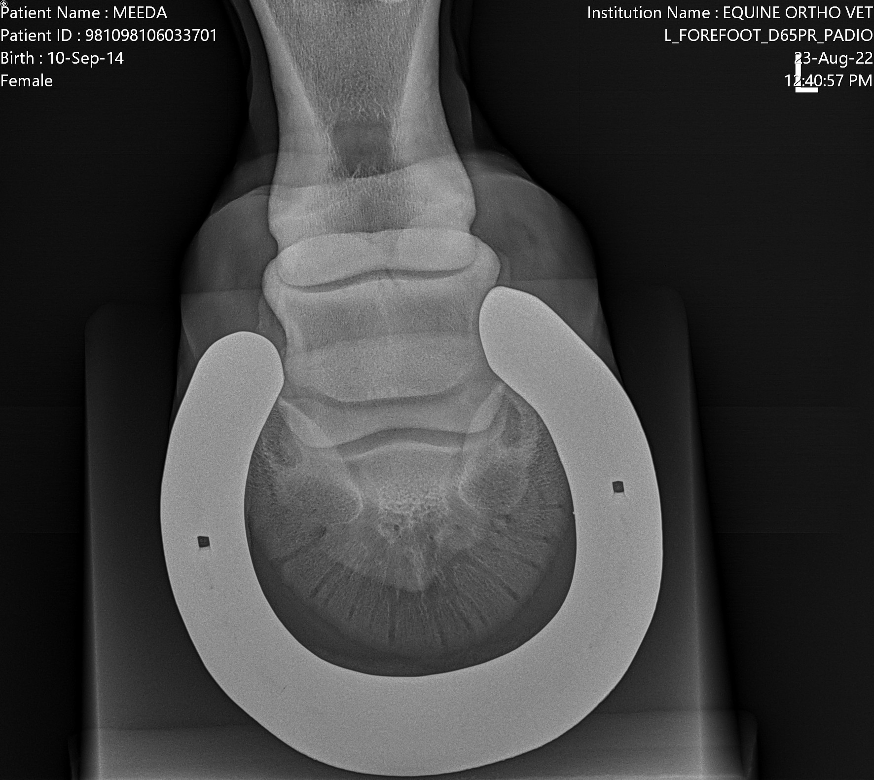 Belgian Horse Trading | 5. Meeda