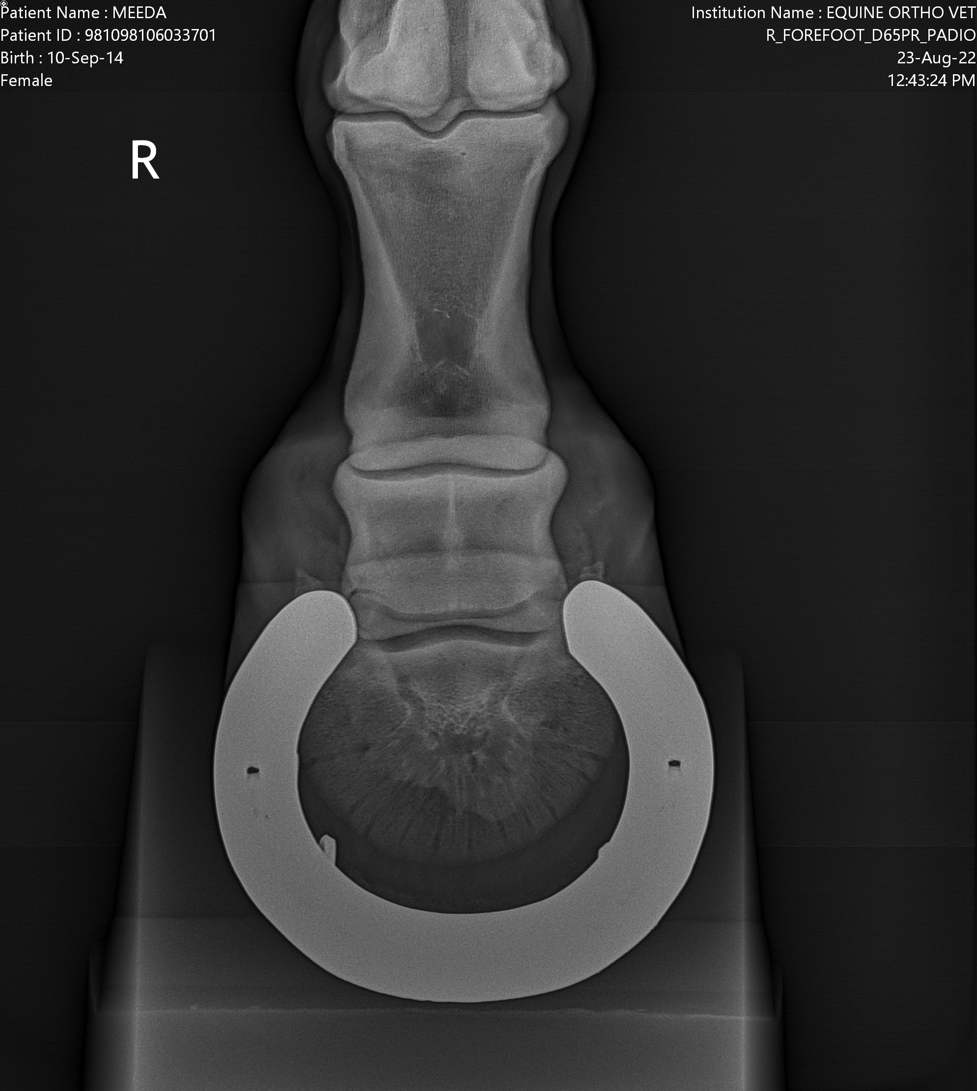 Belgian Horse Trading | 5. Meeda